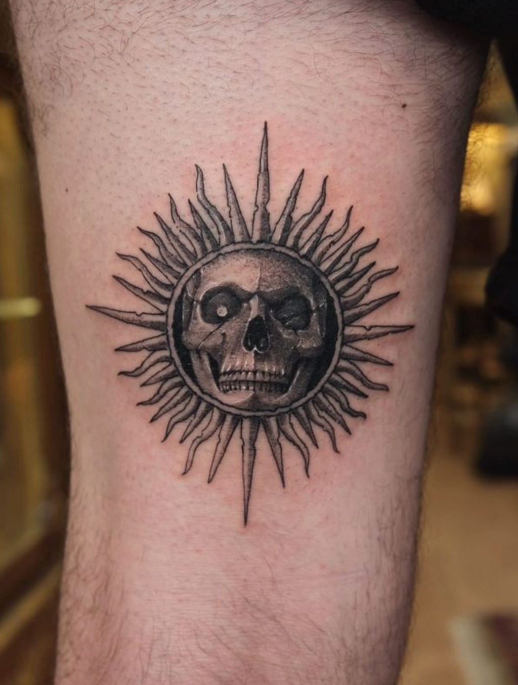 Des Deposit Chronic Ink